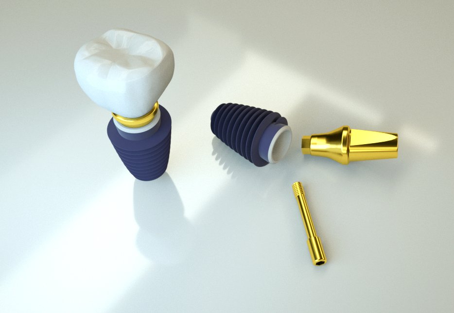 dental implant 3D Models in Medical Equipment 3DExport
