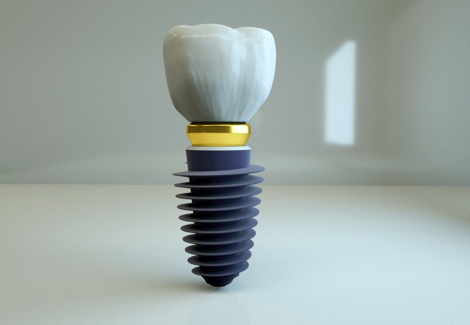 Dental implant 3D Model in Medical Equipment 3DExport
