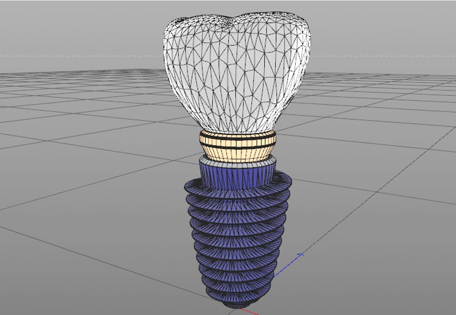 Dental implant 3D Model in Medical Equipment 3DExport