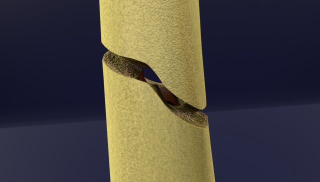 Fracture types labelled 3D Модель in Анатомия 3DExport