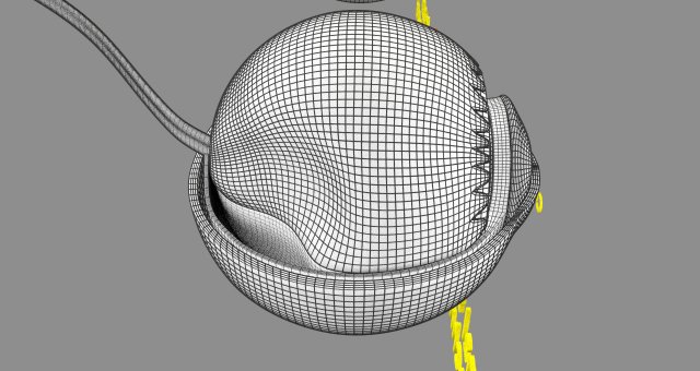 Retinal detachment types eye 3D Model in Anatomy 3DExport