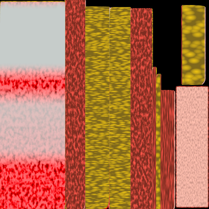 Hypertension blood vessel artery structural change 3D Model in Anatomy ...