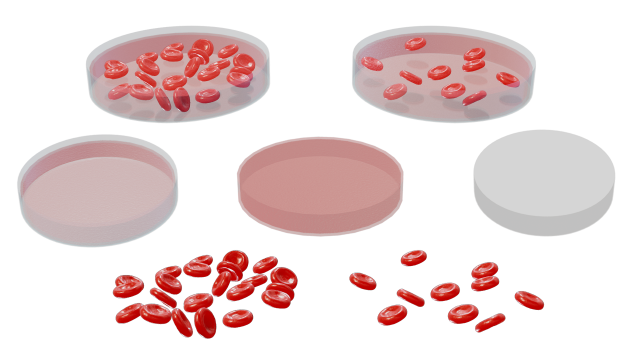 Normal Blood Cells vs Anemia 3D Model in Anatomy 3DExport