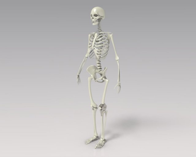 Knee Tumor Prosthesis 3D 모델 in 의료 기기 3DExport