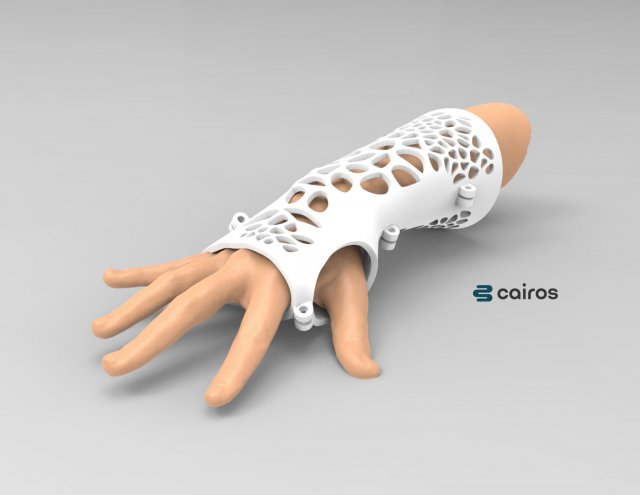 arm splint - 3d print Modelo de impresión 3D in Ingeniería 3DExport