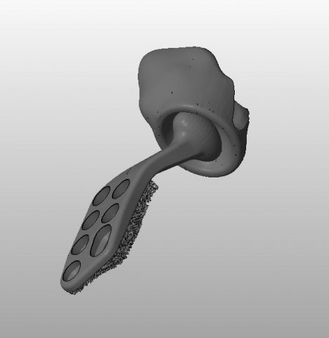 individual tmj prosthesis real operation 3D Model in Medical Equipment ...