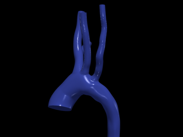 Aorta 3D Model in Medicines 3DExport