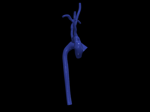 Aorta 3D Model in Medicines 3DExport
