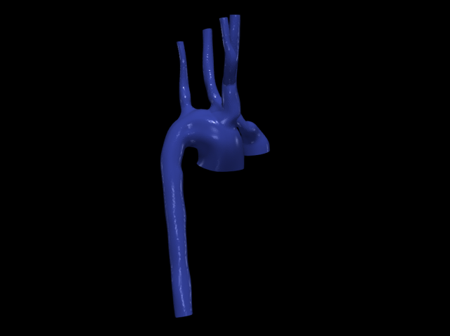 Aorta 3D Model in Medicines 3DExport