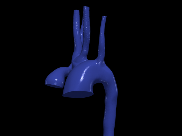 Aorta 3D Model in Medicines 3DExport