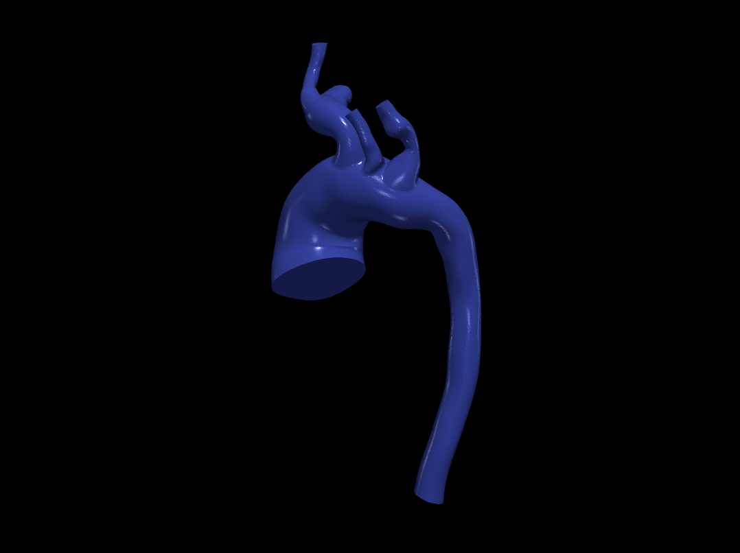 Aorta 3D Models in Medicines 3DExport