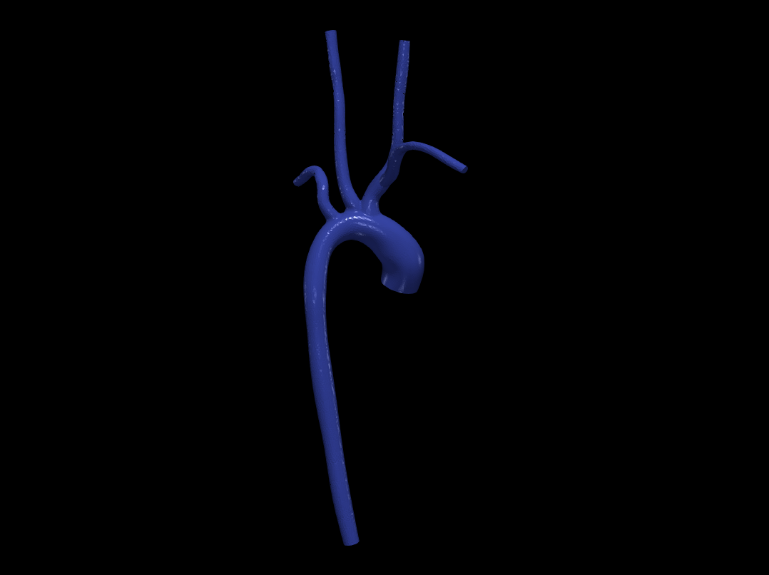 Aorta 3D Models in Medicines 3DExport
