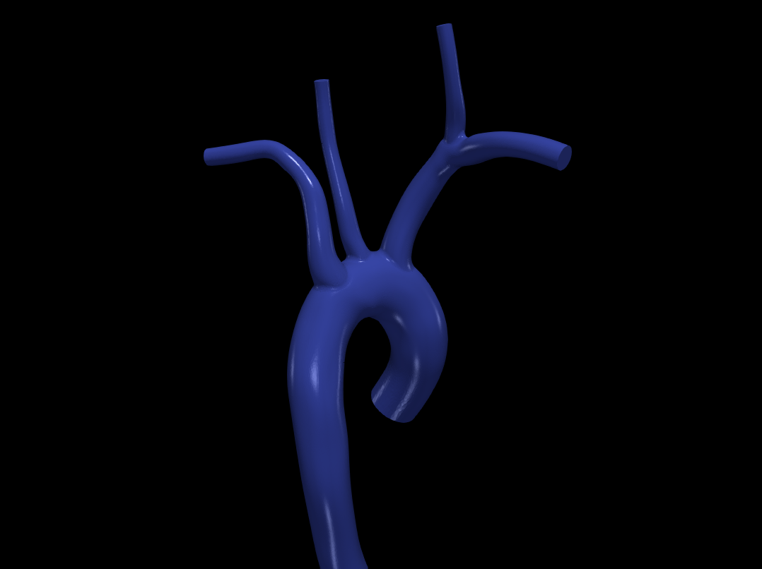Aorta 3D Models in Medicines 3DExport