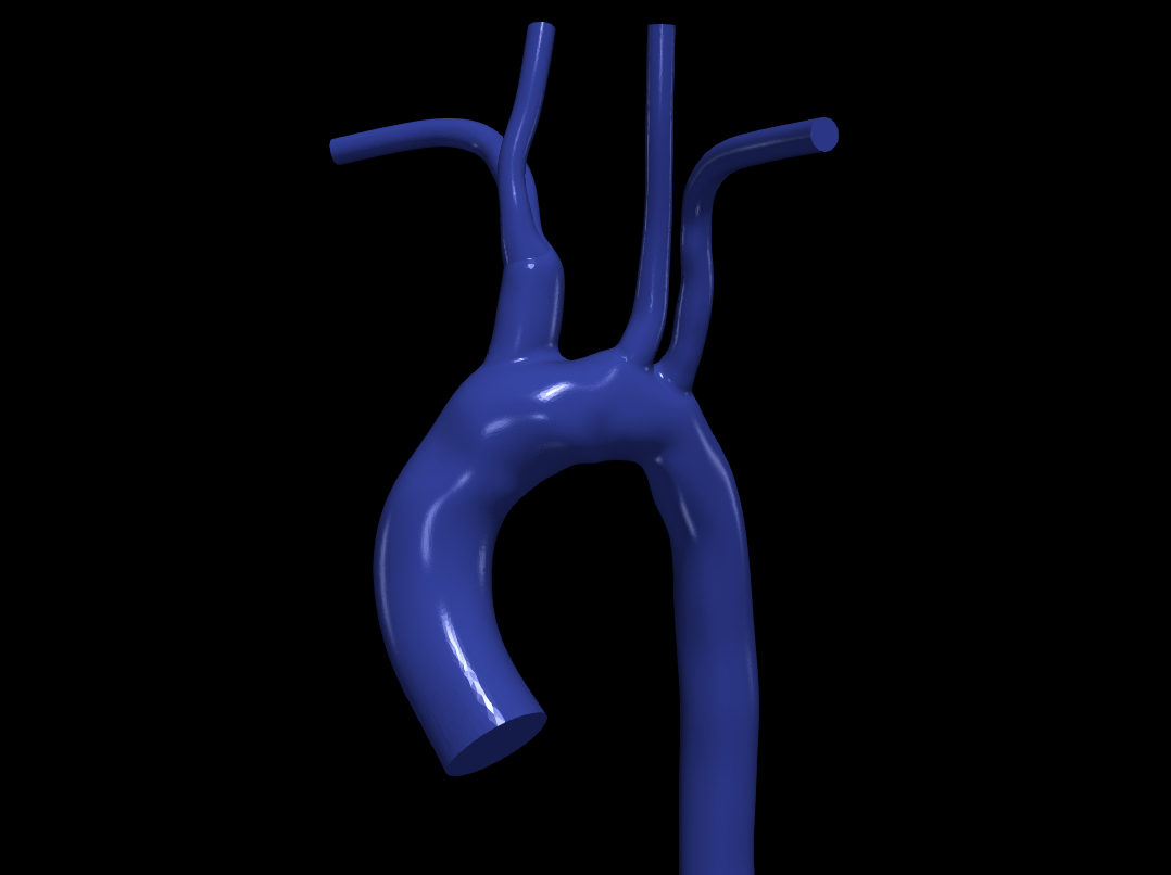 Aorta 3D Models in Medicines 3DExport