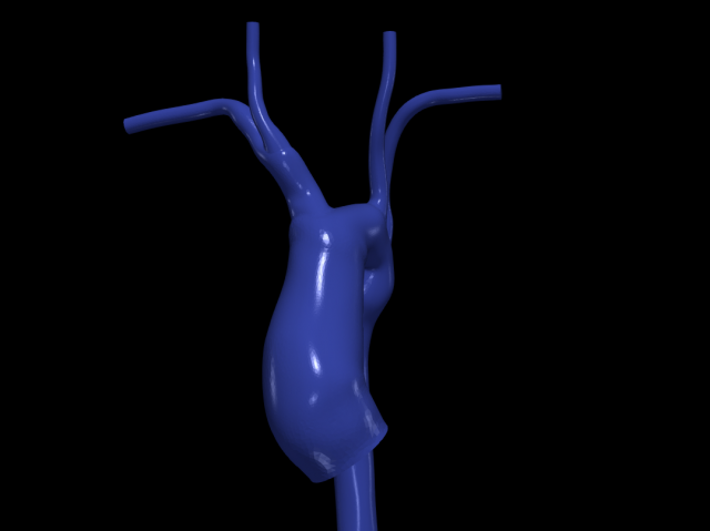 Aorta 3D Model in Medicines 3DExport