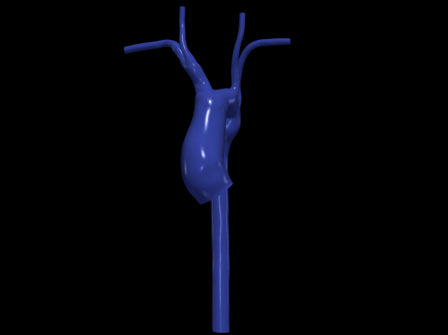 Aorta 3D Model in Medicines 3DExport