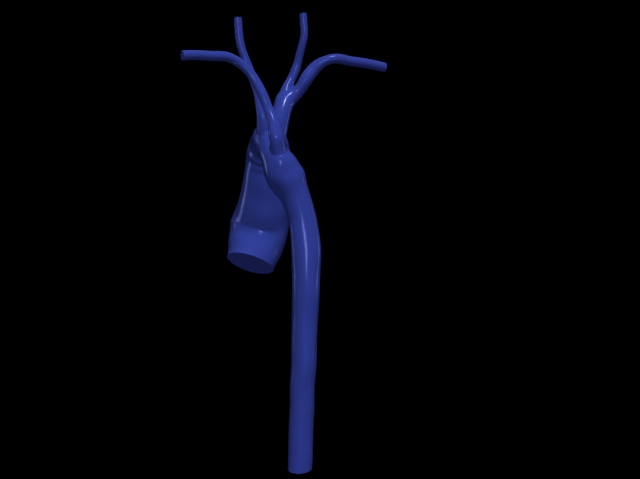 Aorta 3D Model in Medicines 3DExport