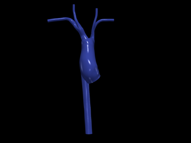 Aorta 3D Model in Medicines 3DExport
