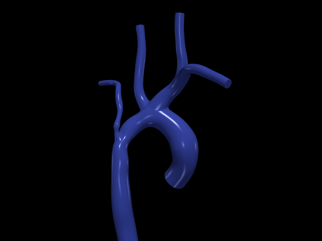 Aorta 3D Models in Medicines 3DExport