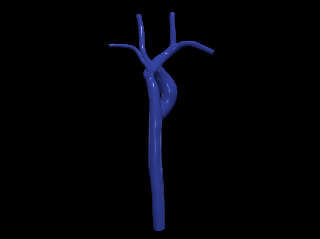 Aorta 3D Models in Medicines 3DExport