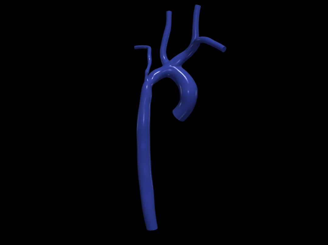 Aorta 3D Models in Medicines 3DExport