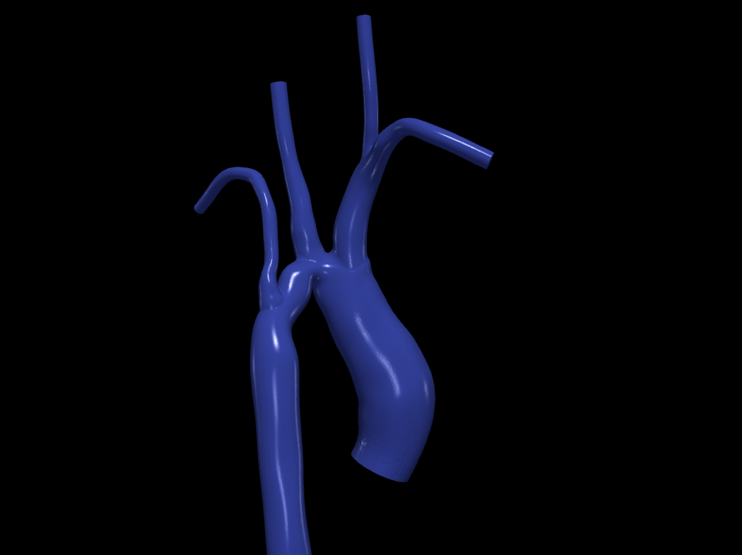 Aorta 3D Models in Medicines 3DExport