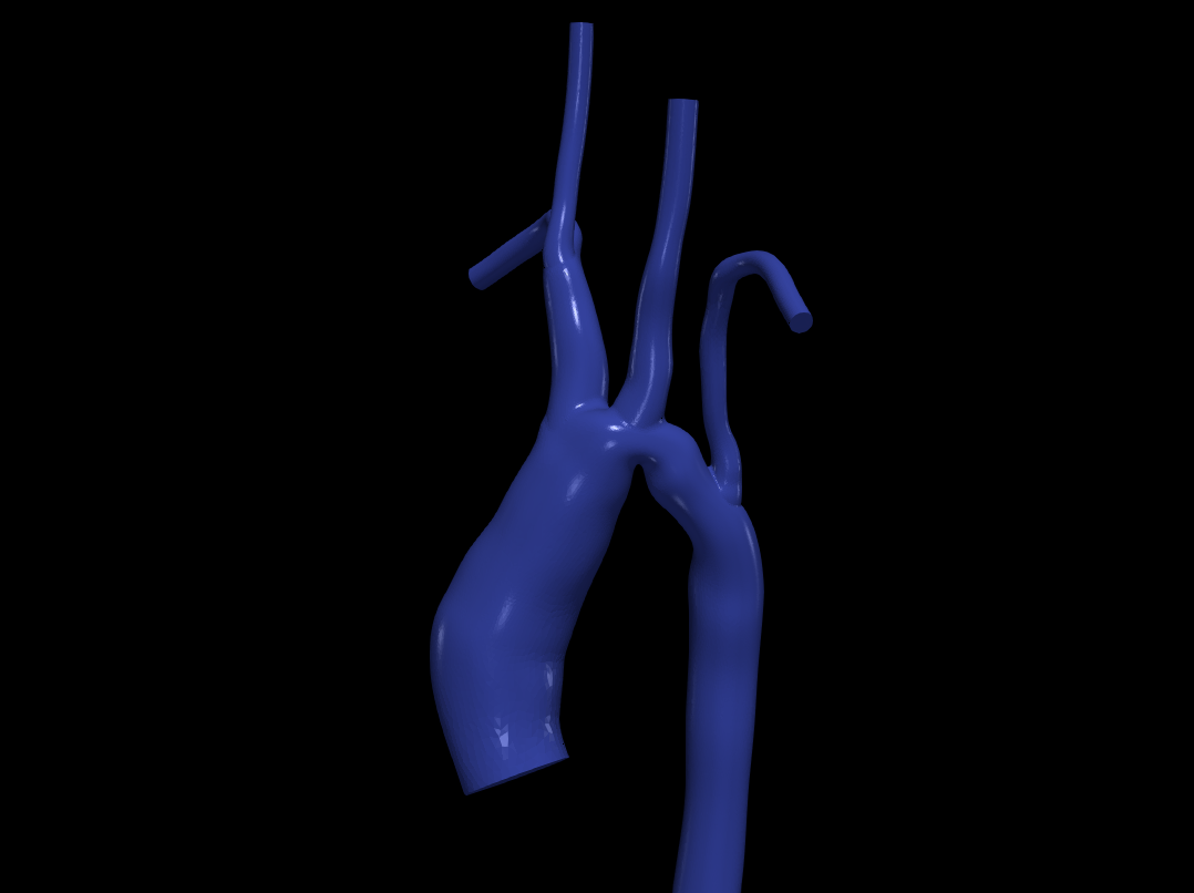 Aorta 3D Models in Medicines 3DExport