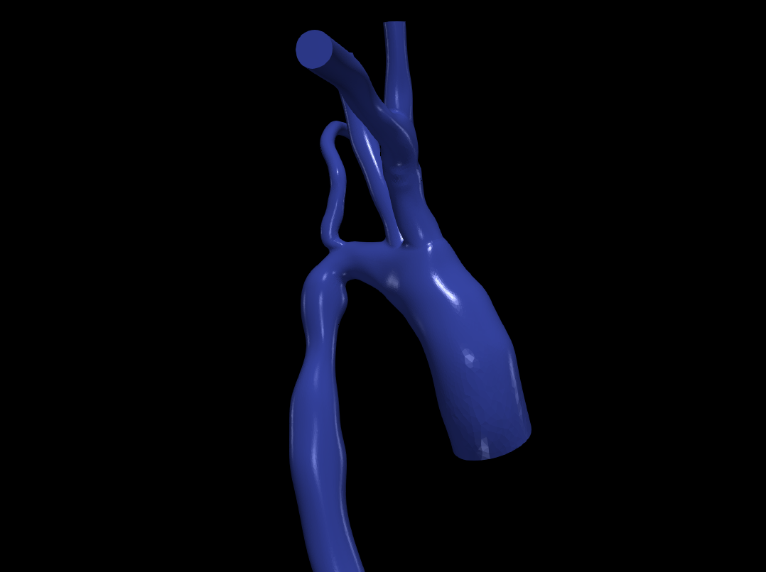 Aorta 3D Models in Medicines 3DExport