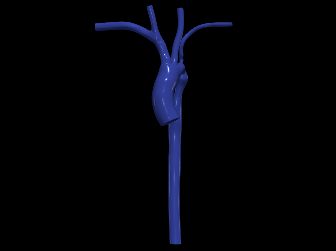 Aorta 3D Models in Medicines 3DExport