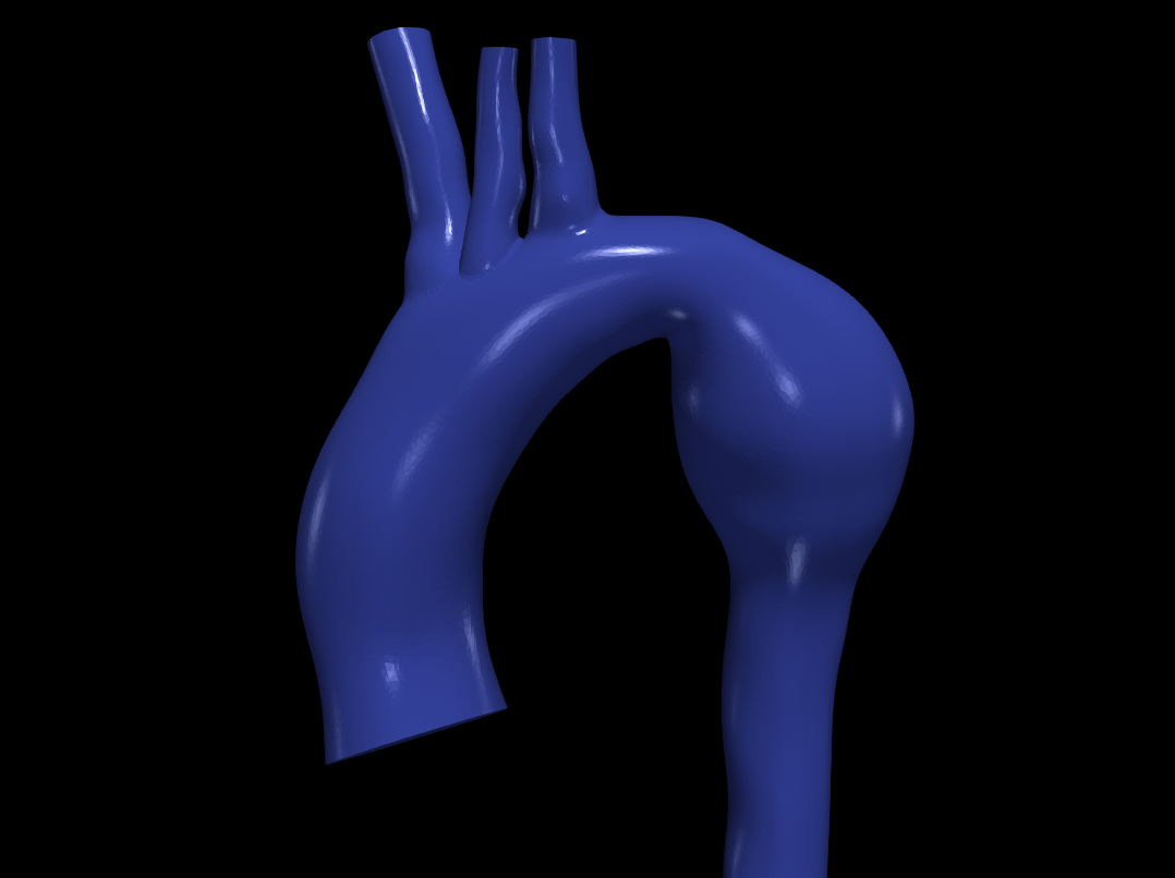 Aorta 3D Models in Medicines 3DExport