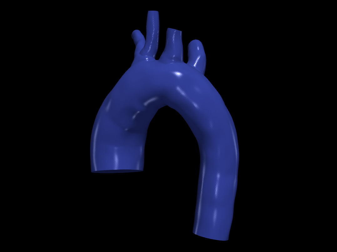 Aorta 3D Models in Medicines 3DExport
