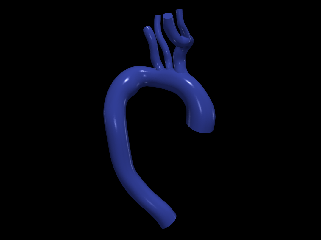 Aorta 3D Models in Medicines 3DExport