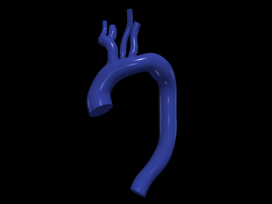 Aorta 3D Models in Medicines 3DExport