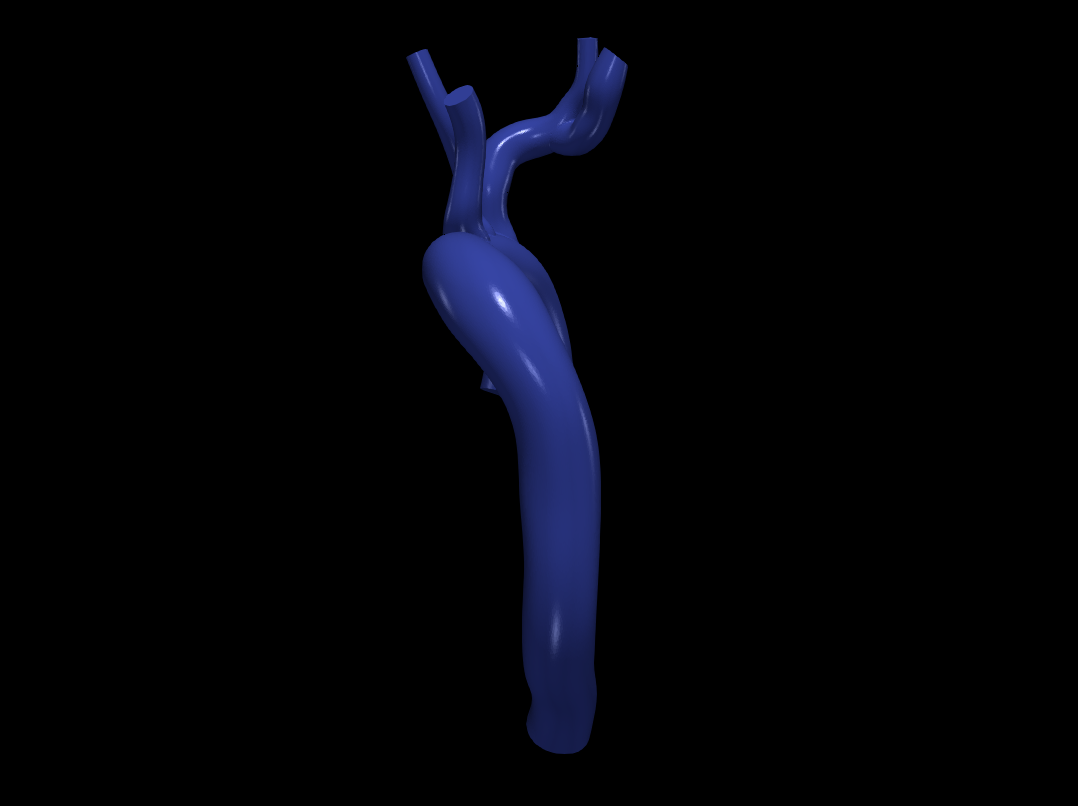 Aorta 3D Models in Medicines 3DExport