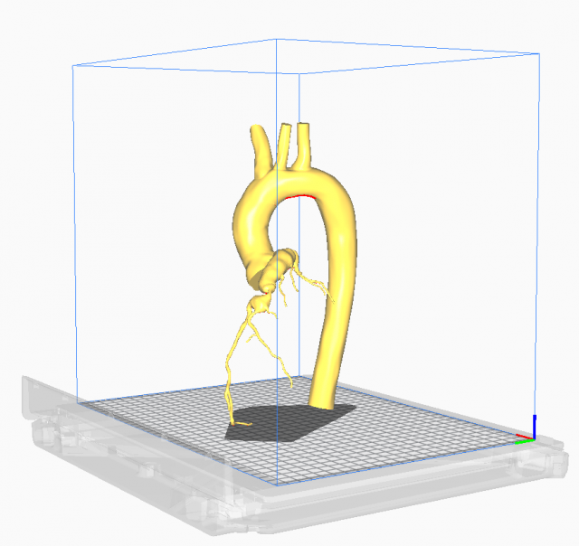 Coronary arteries and aorta 3D Model in Medicines 3DExport