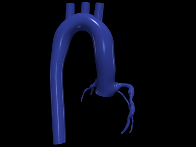 Coronary arteries and aorta 3D Model in Medicines 3DExport