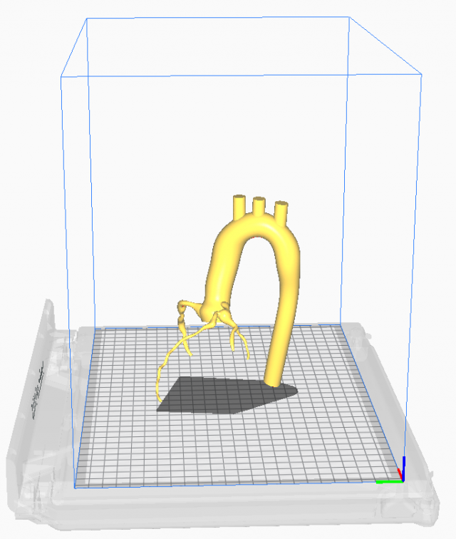 Coronary arteries and aorta 3D Model in Medicines 3DExport
