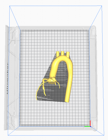 Coronary arteries and aorta 3D Model in Medicines 3DExport