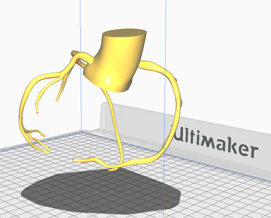 Coronary arteries 3D Models in Medicines 3DExport