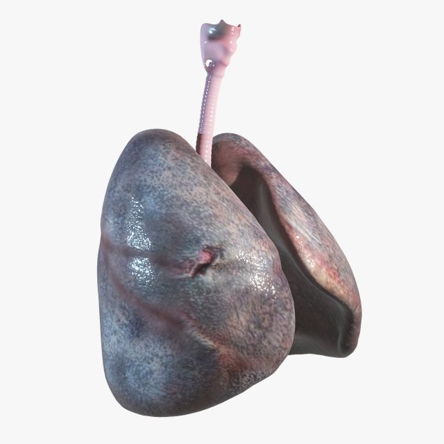 Smokers Lungs 3D Model in Anatomy 3DExport