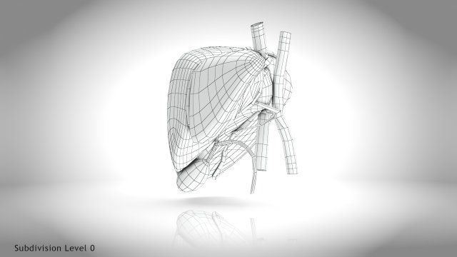 Cirrhosis Liver Disease 3D Model in Medicines 3DExport